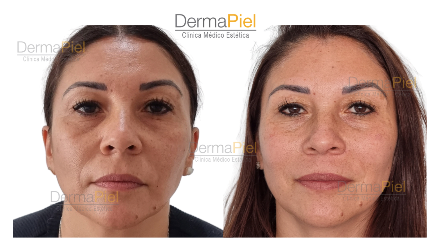 Dolor En Los Pomulos De La Cara at Wilbur Pritt blog